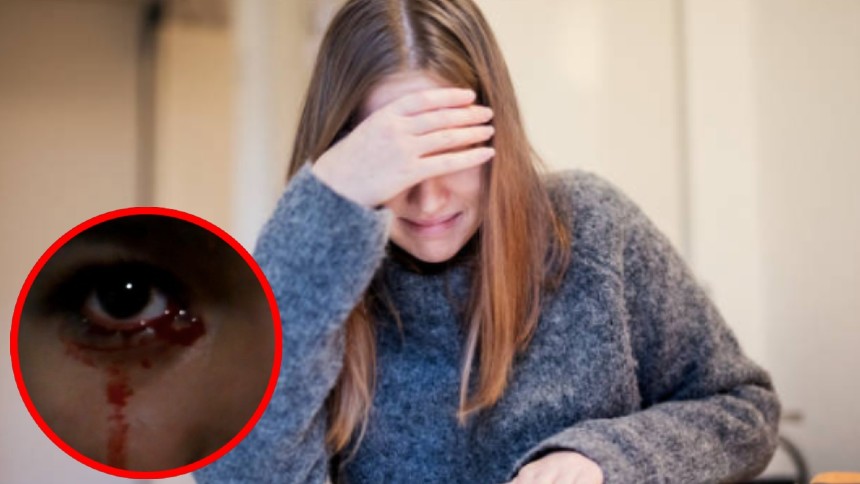EN VIDEO: El extraño caso de una joven que llora sangre