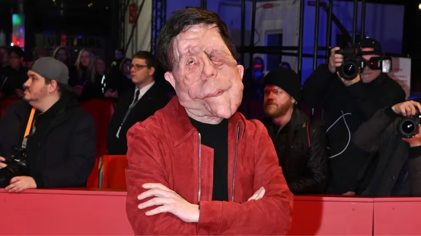 La historia de Adam Pearson, el actor con una rara condición